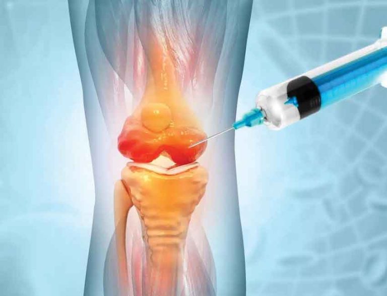 Joint Injections - Shingle Creek Medical Group