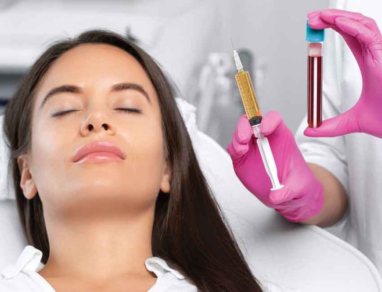 PRP (PLATELET-RICH PLASMA) - Shingle Creek Medical Group